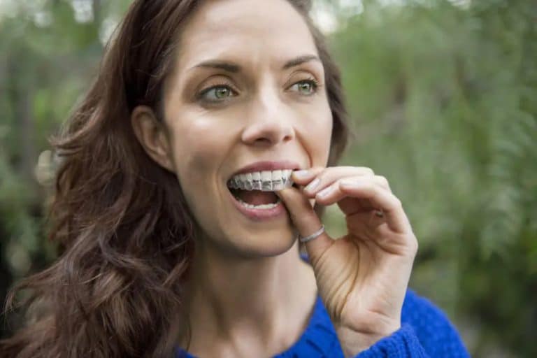 Onzichtbare beugel: Invisalign® - Apollo